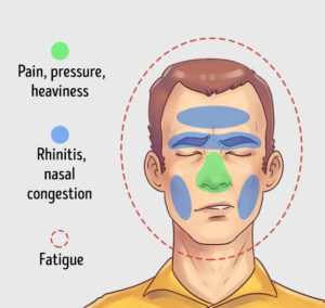 5 Different Types of Headaches And How To Get Rid of Them