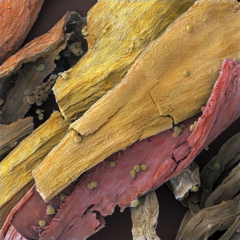 15 Food Photographed Taken Under the Microscope Like You’ve Never Seen ...