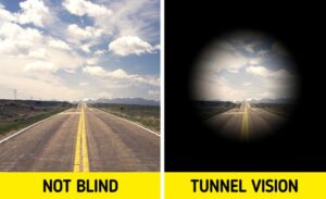 How People With Different Degrees and Causes of Impaired Vision ...