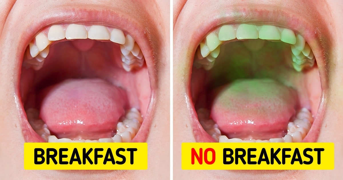 5 Proven Ways to Get Fresh Breath Naturally (Backed by Science)